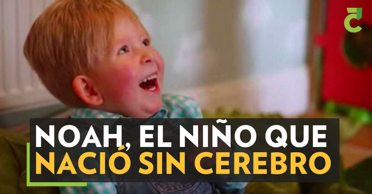 Noah, el niño que nació sin cerebro