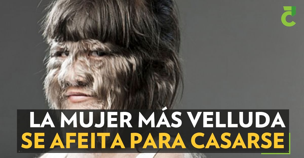 La mujer más velluda se afeita para casarse