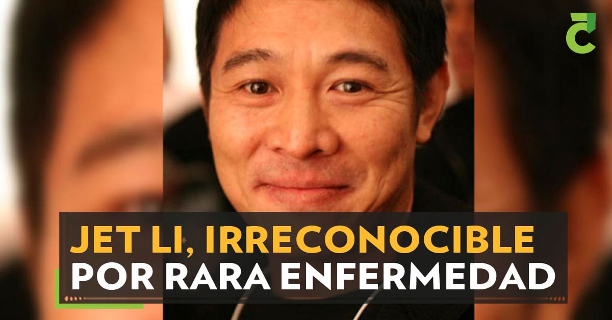 Jet Li, irreconocible por rara enfermedad