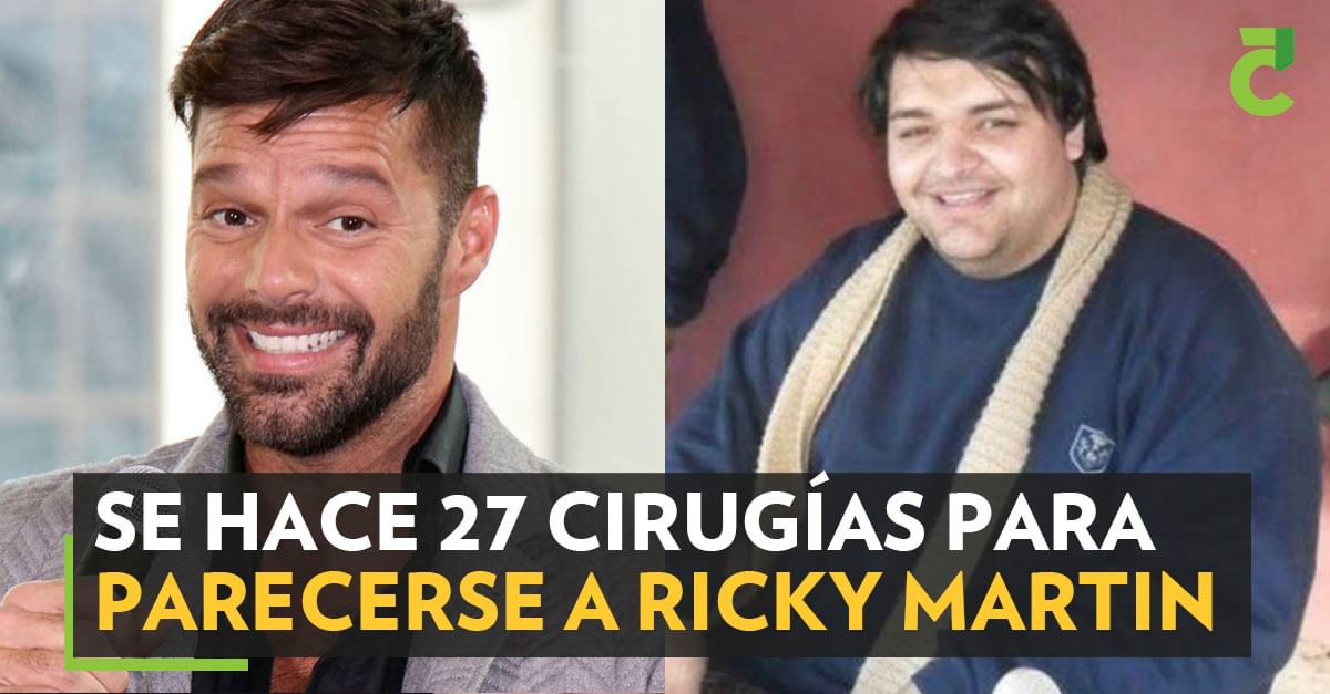 Se hace 27 cirugías para parecerse a Ricky Martin