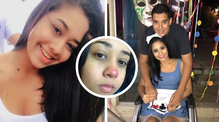 Joven se hace perforación en la nariz; termina paralítica