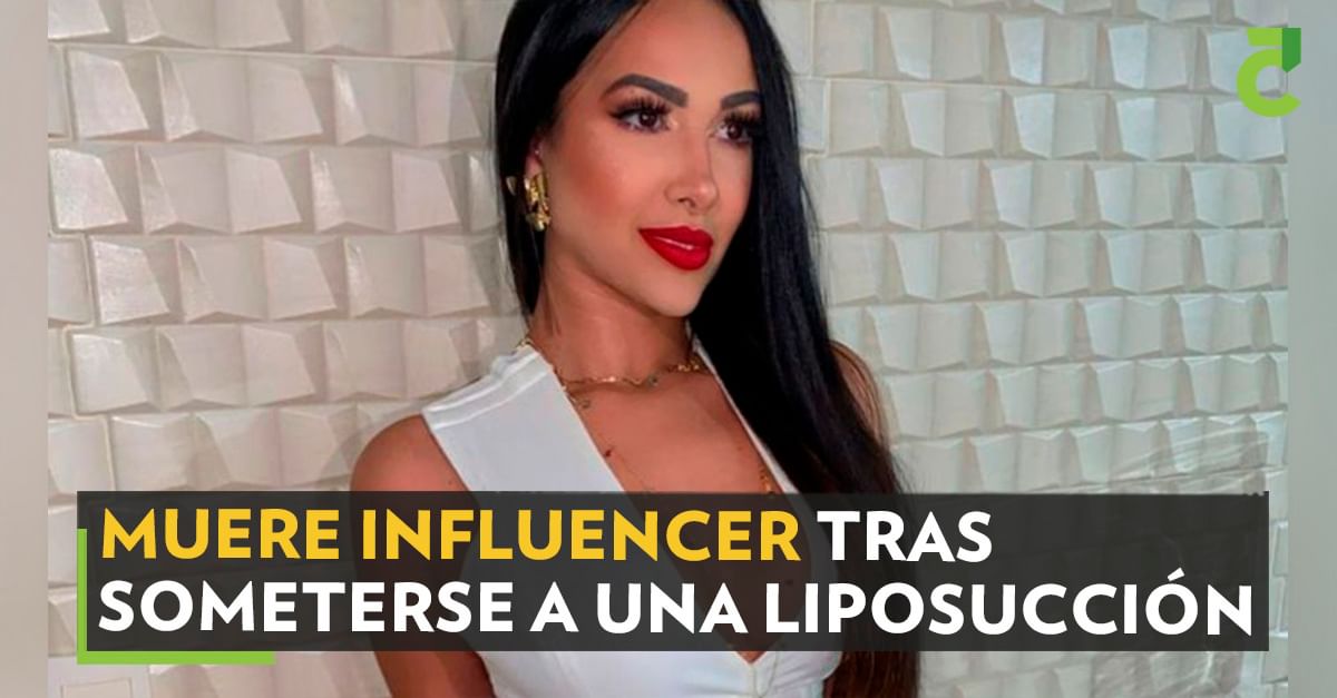 Muere Influencer Tras Someterse A Una Liposucción 1276
