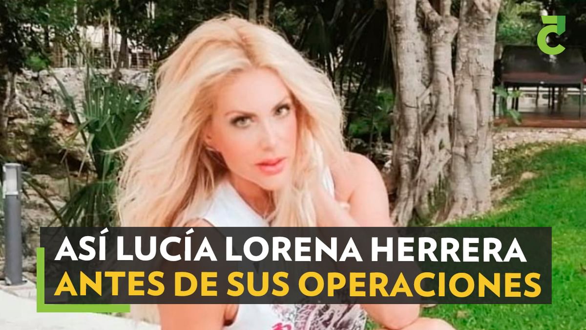 Así lucía Lorena Herrera antes de sus operaciones