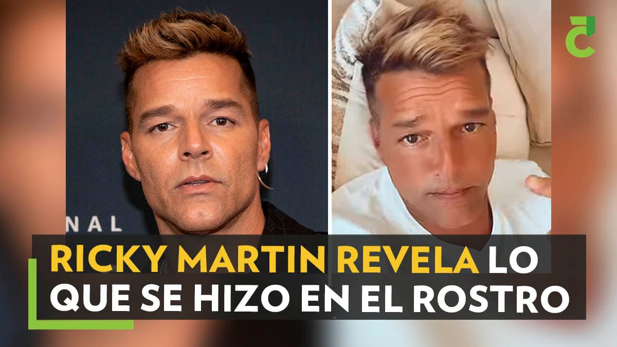 Ricky Martin revela lo que se hizo en el rostro