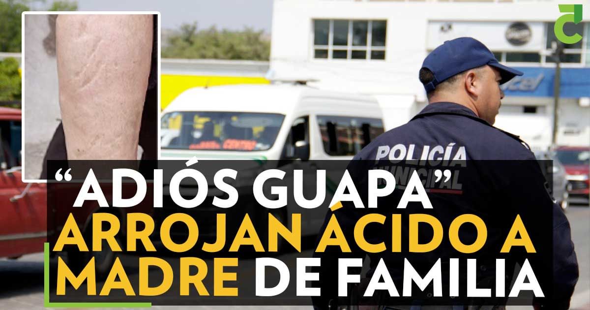 “Adiós Guapa” arrojan ácido a madre de familia