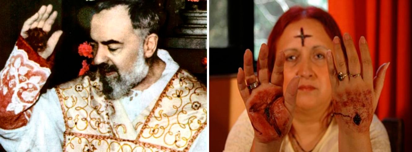 ¿Qué son los estigmas y por qué salen a las personas?