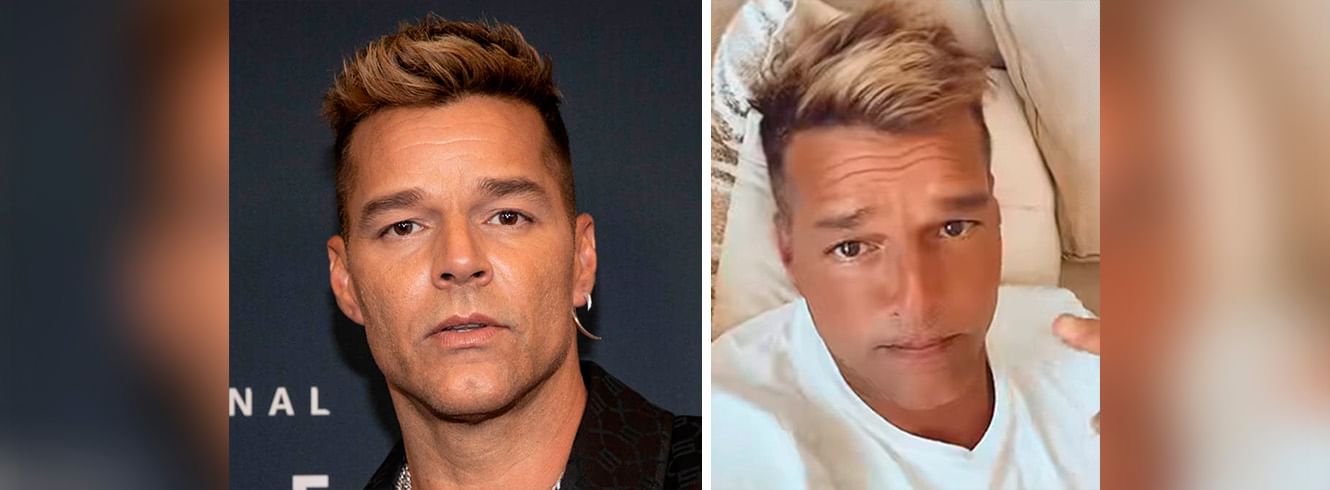 Ricky Martin revela lo que se hizo en el rostro