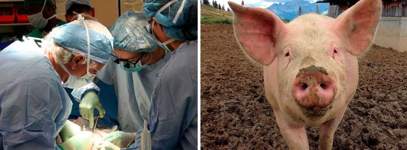 Muere primer persona con corazón de cerdo