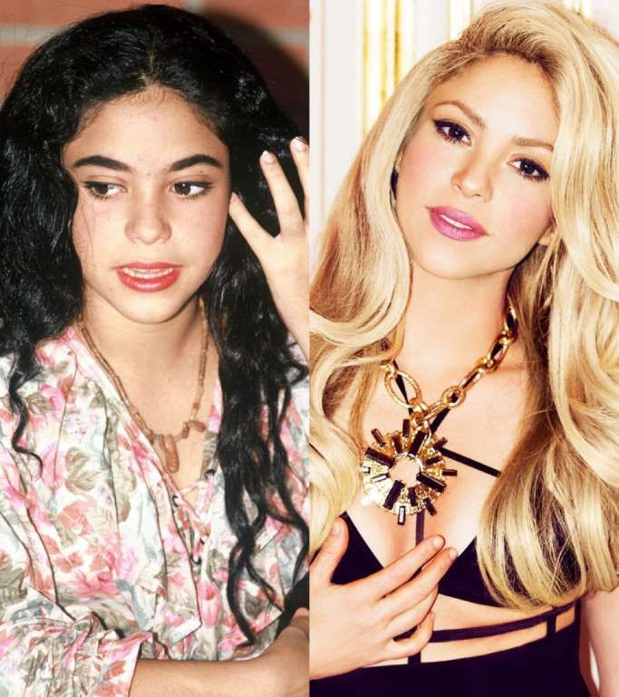 Revelan las cirugías de Shakira