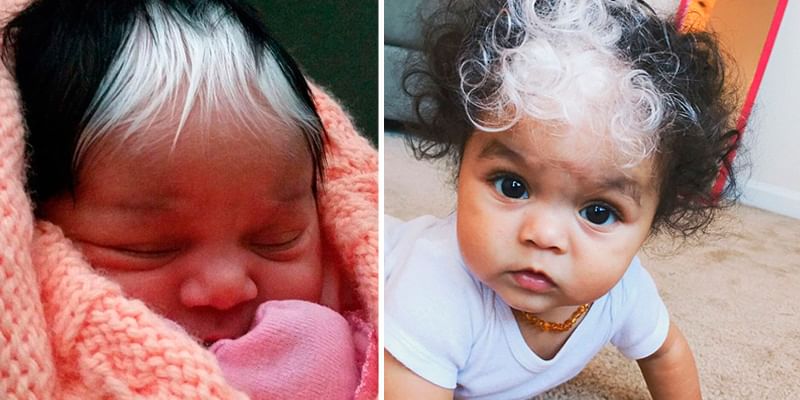 Bebé nace con mechón blanco como su madre