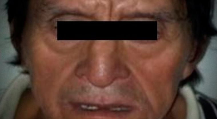 Padrastro le quema los pies